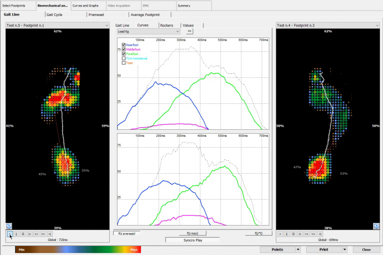 Pressure Mapping & Common Conditions - Stepforce