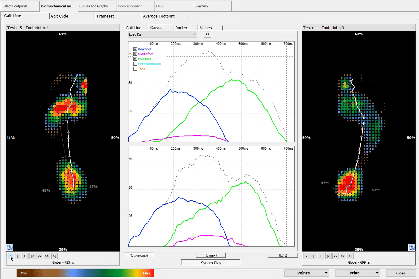 Plantar Pressure Data Acquisition and Analysis - Stepforce
