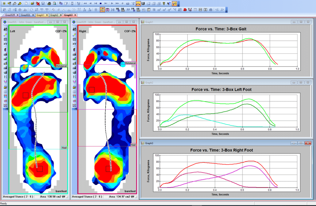 Biomechanical Foundations of Force - Tekscan Training - Stepforce